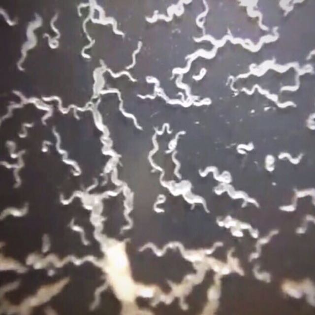 Starter Culture- Microworms (Ideal For Young Fry) – Blackwater Aquariums